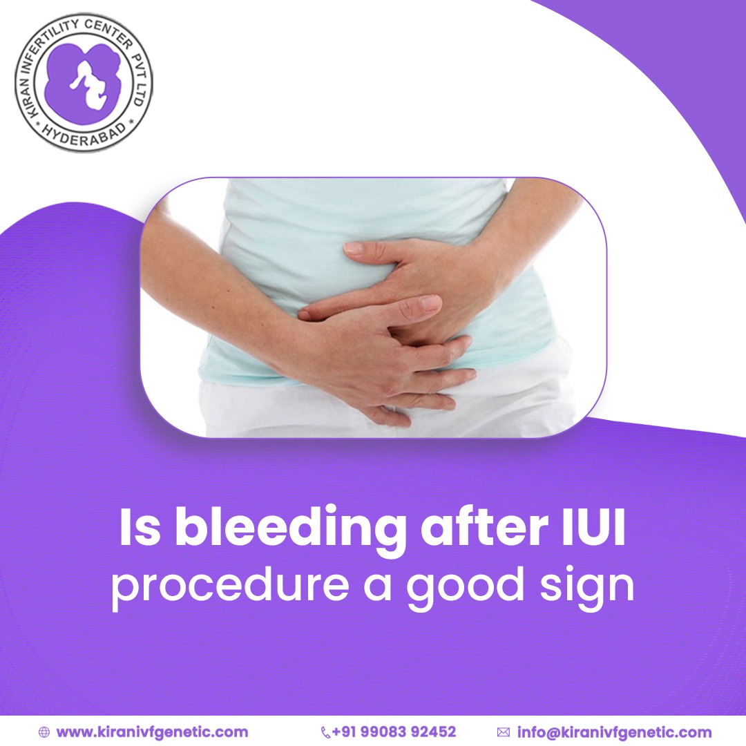 Is Bleeding After IUI Procedure A Good Sign Surrogacy India Is Bleeding After IUI Procedure A Good Sign Surrogacy India
